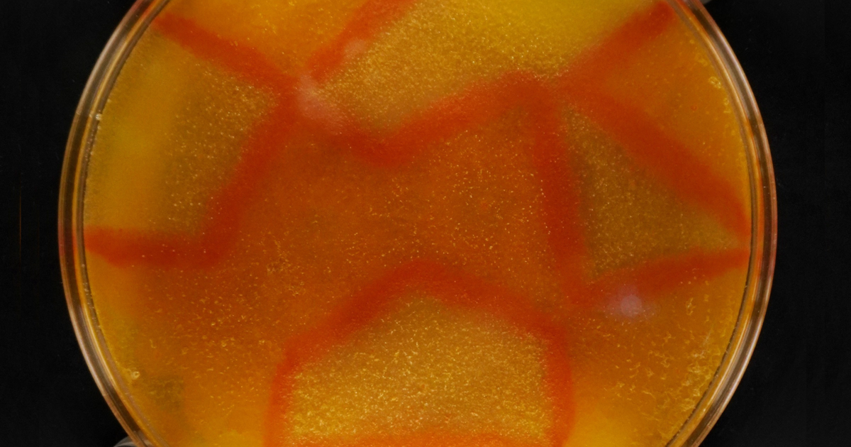 Blakeslea trispora: The Fungus that Adds Colour to Nature and Food ...